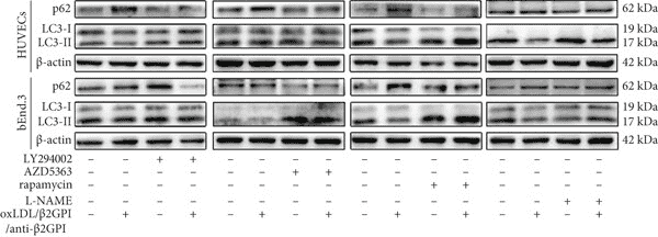 AbMole小课堂丨L-NAME（NG-Nitroarginine methyl ester）：从高血压动物模型构建到免疫学研究的重要工具 | AbMole